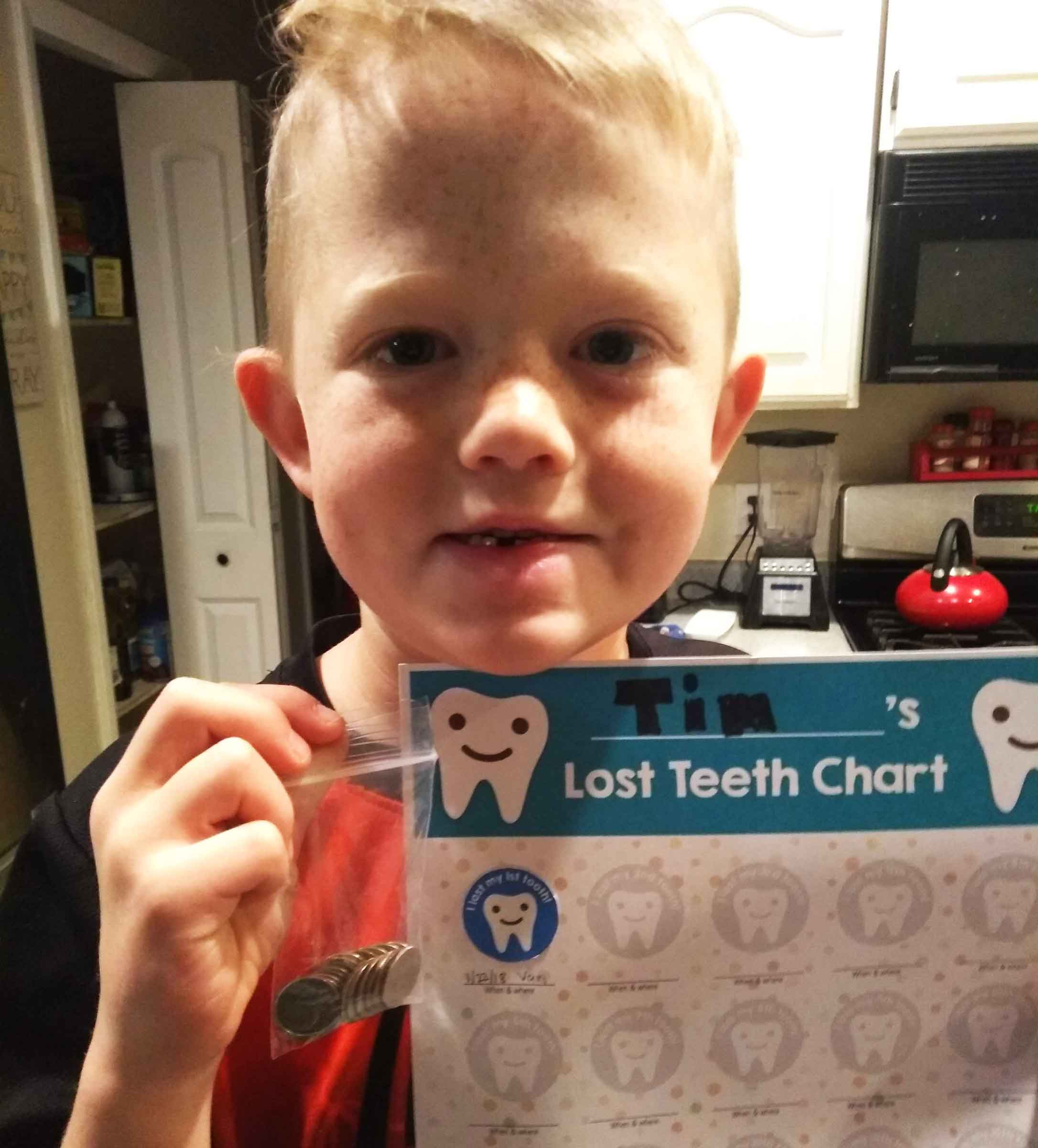 FREE Tooth Fairy lost teeth chart and badge - My Silly Squirts
